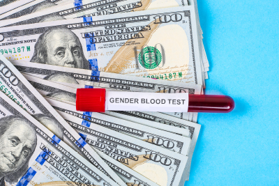 How Much Is a Gender Blood Test? | SneakPeek®